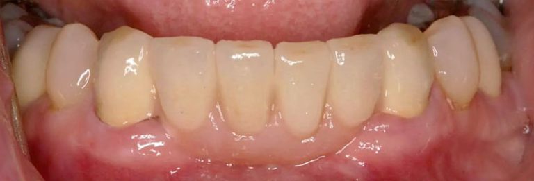 Smile Gallery - Sylacauga - Columbiana - Luma Dentistry