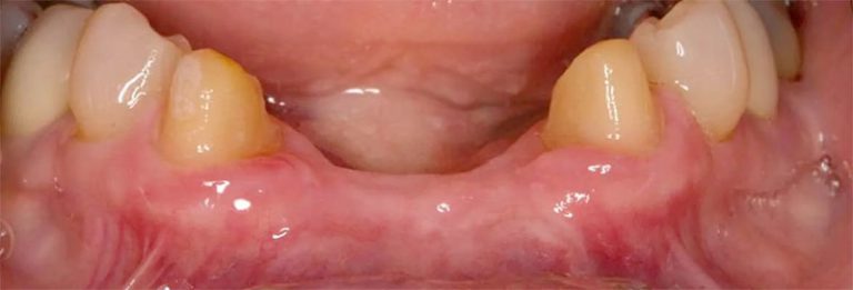 Smile Gallery - Sylacauga - Columbiana - Luma Dentistry