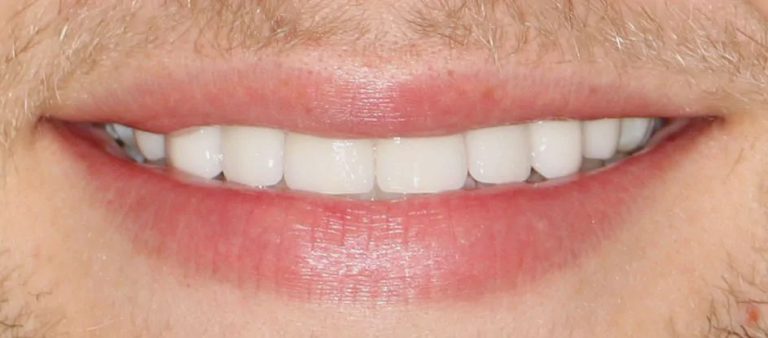 Smile Gallery - Sylacauga - Columbiana - Luma Dentistry