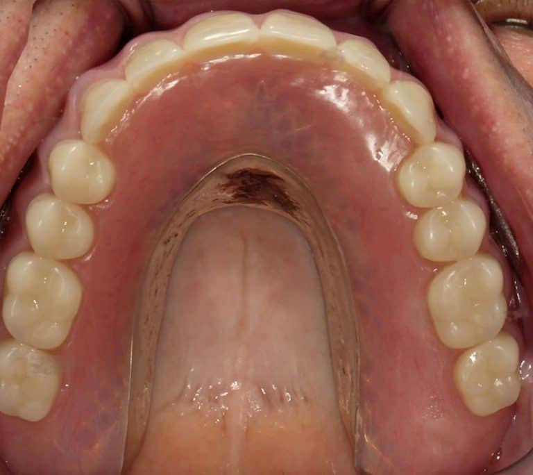 Smile Gallery - Sylacauga - Columbiana - Luma Dentistry